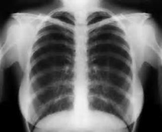 Nelson Refining - Quote Request